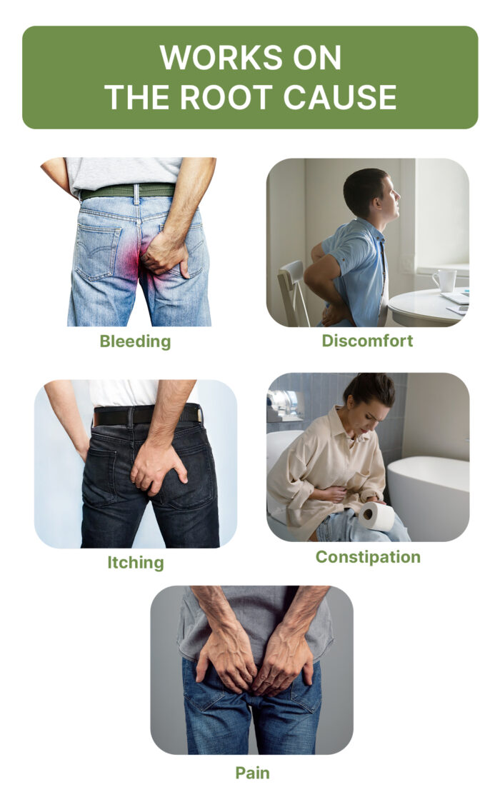 Piles Care Kit – The Natural help for Piles, Fissure & Fistula – Queensveda